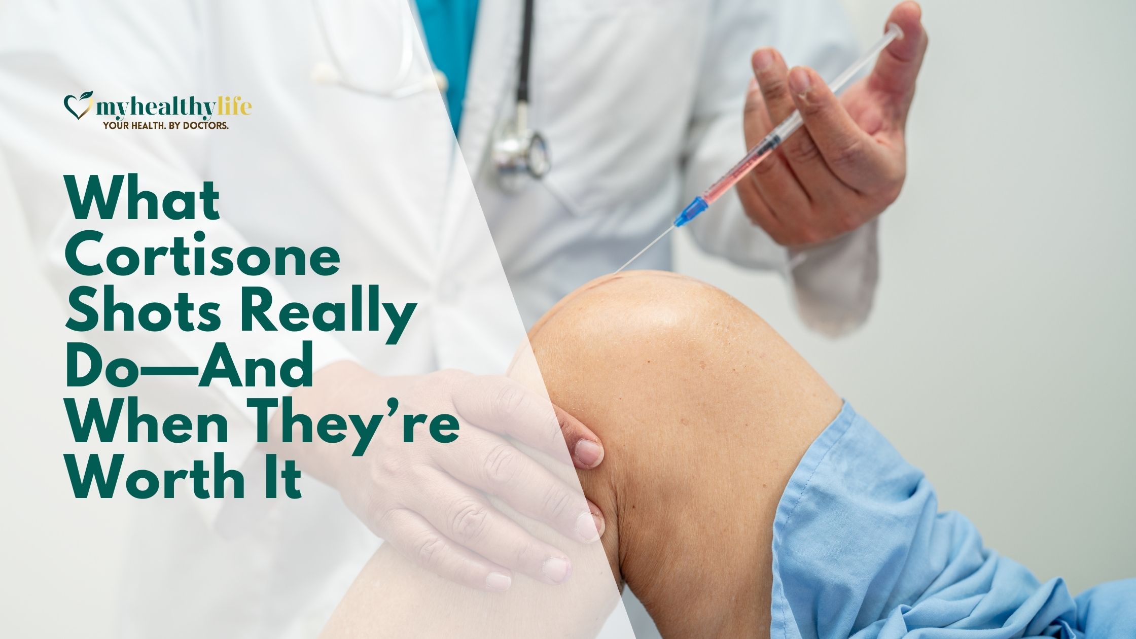What Cortisone Shots Really Do—And When They’re Worth It